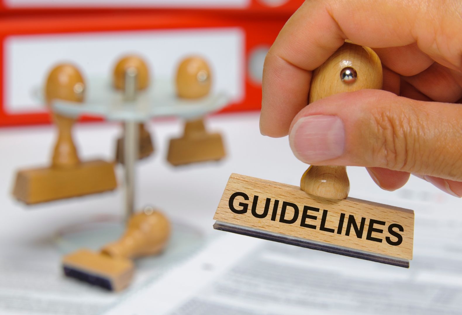 What Are Amazon's Condition Guidelines? | Simpl Fulfillment